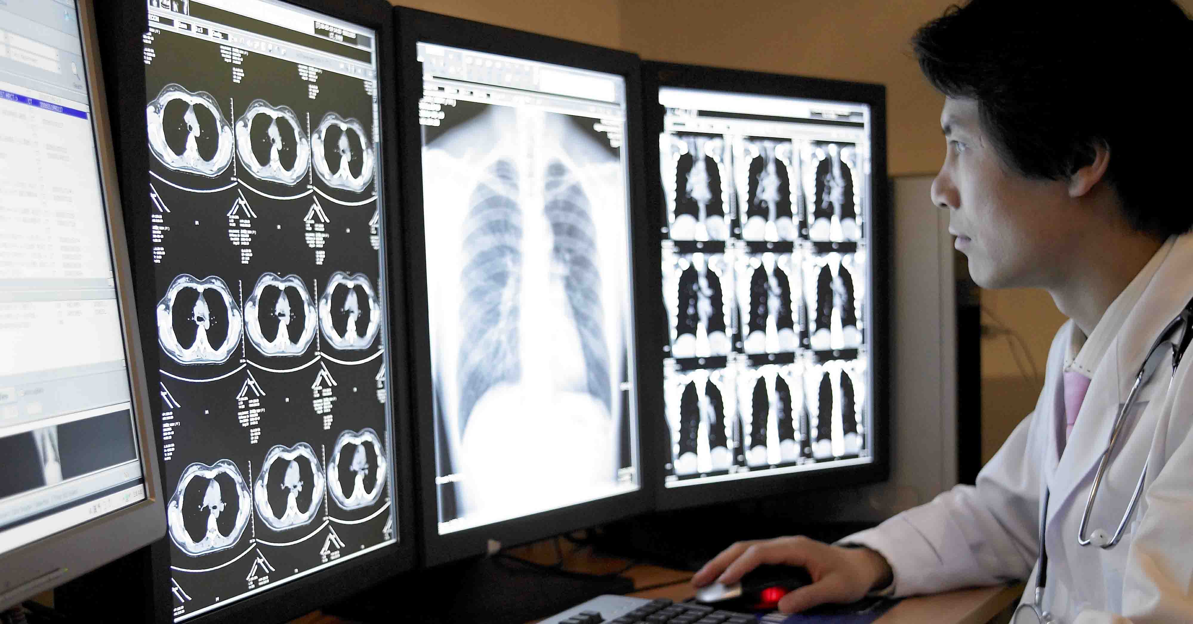 Houston Methodist Lung Center