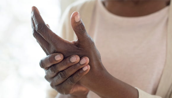 Damages Of Popping Knuckles