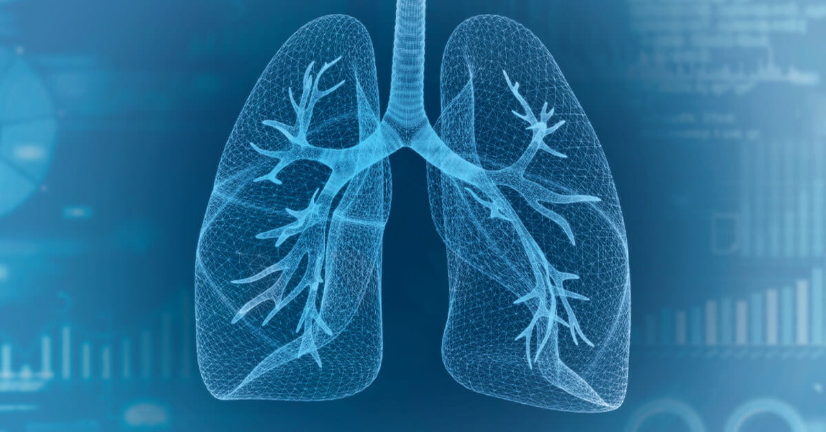 Lung Cancer Screening Whos Eligible And Why Its Important Houston