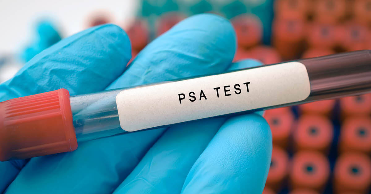Elevated PSA: What It Means for Prostate Cancer Screening