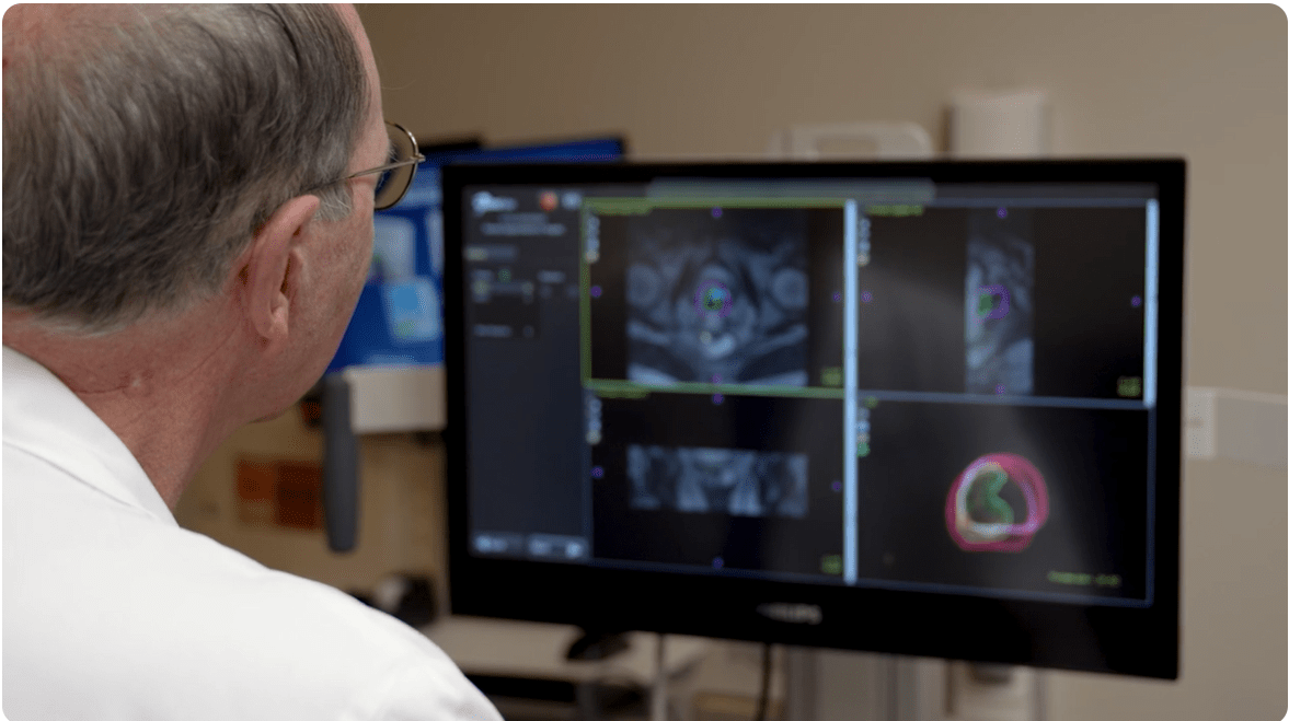 Prostate Cancer: Symptoms, Causes, Screening, & Diagnosis | Houston ...