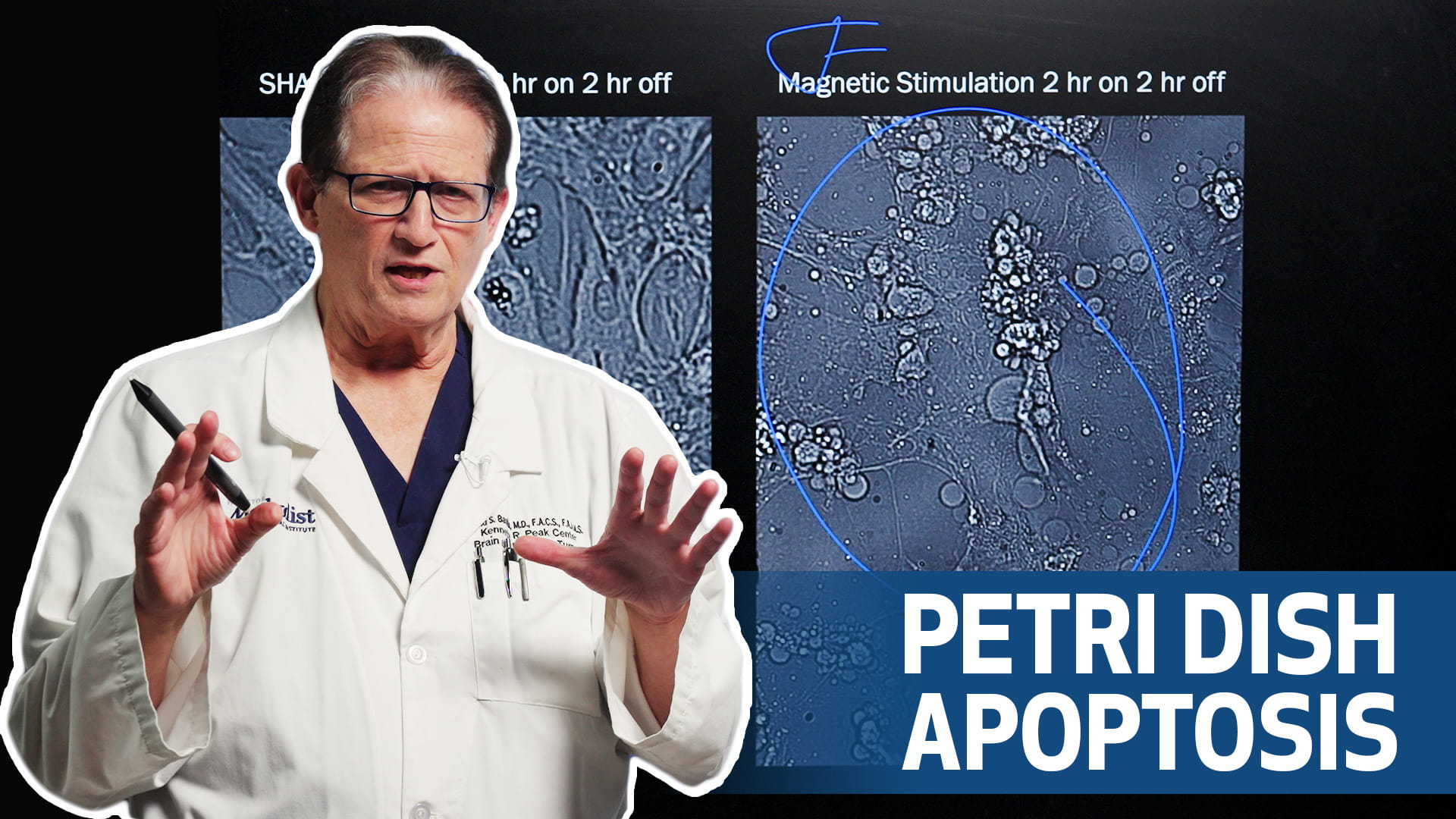 WATCH: Houston Methodist Explores Novel Noninvasive Oncomagnetic ...