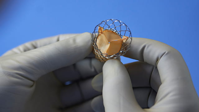 TAVI Shows Durable Benefits in Three-Year, Low-Risk Clinical Trial ...