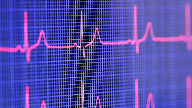 American Heart Association Scientific Sessions 2023 Features Prominent ...