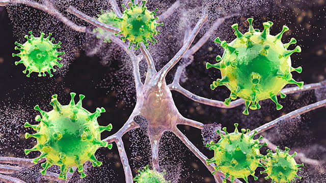 Study: COVID-19 Can Accelerate Brain Aging, Lead to Irreversible ...