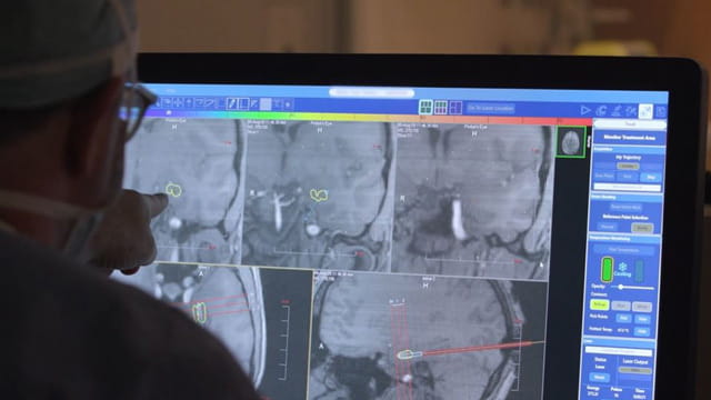 Laser Interstitial Thermal Therapy (LITT) Video: A New Approach to ...