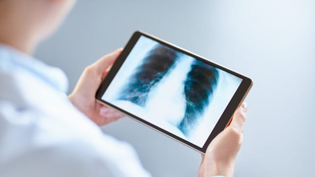 New COPD Treatment Option: Lung Denervation | Houston Methodist Leading ...