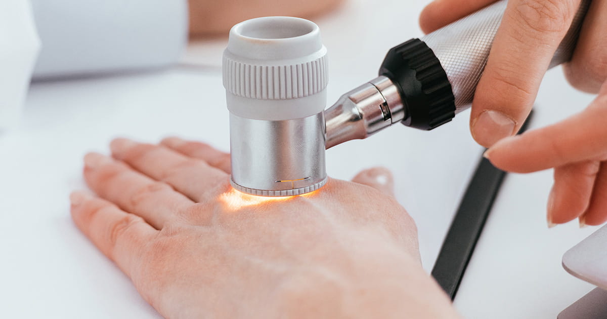 Dermatology: Skin Diseases & Conditions | Houston Methodist