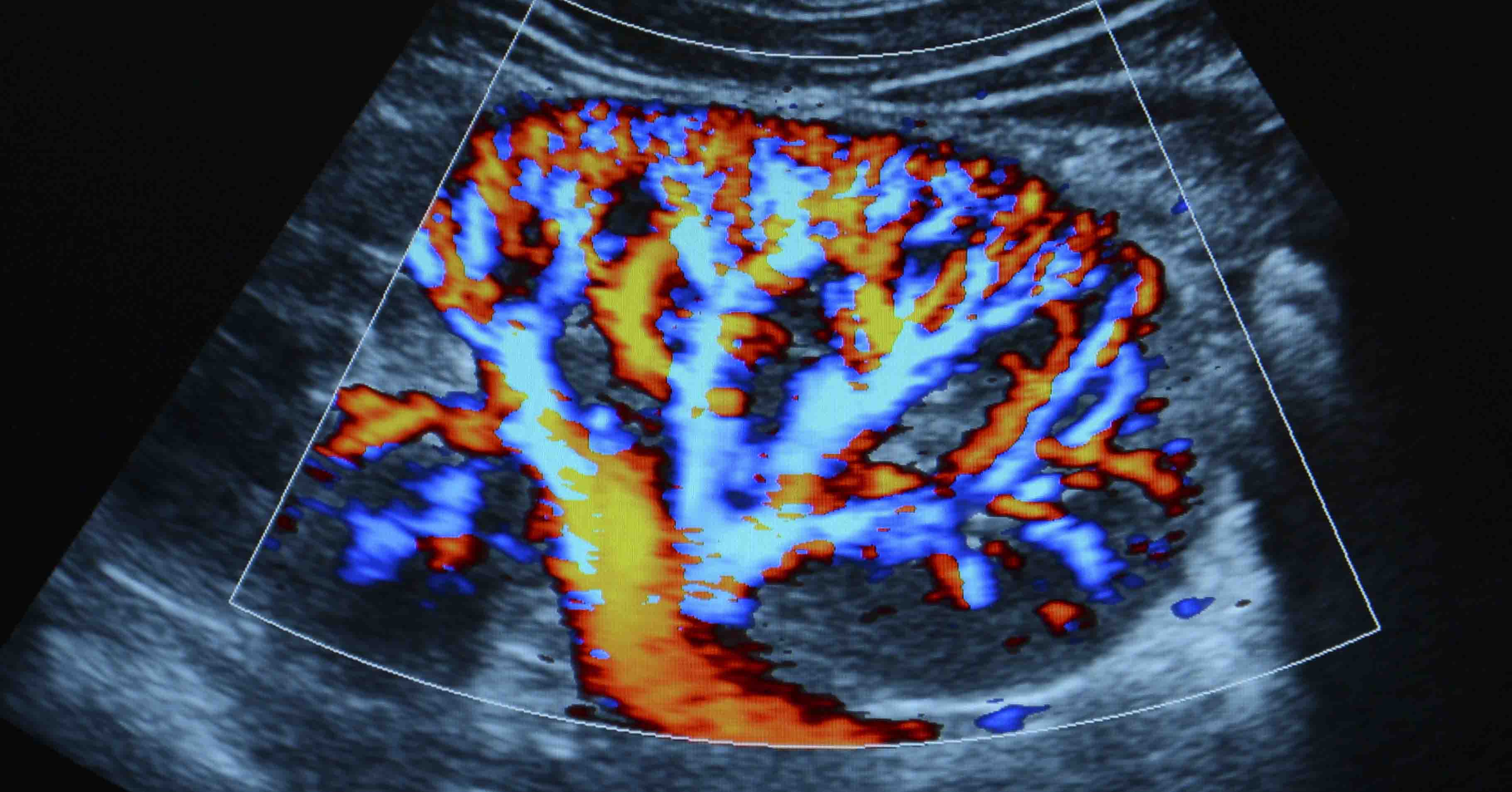 Nephrology | Houston Methodist