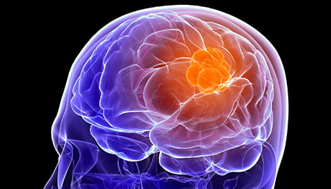 Neurology & Neurosurgery: Neurologist Near Me | Houston Methodist