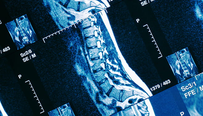 Spine Care: Spine Specialists & Back Doctors Nearby | Houston Methodist